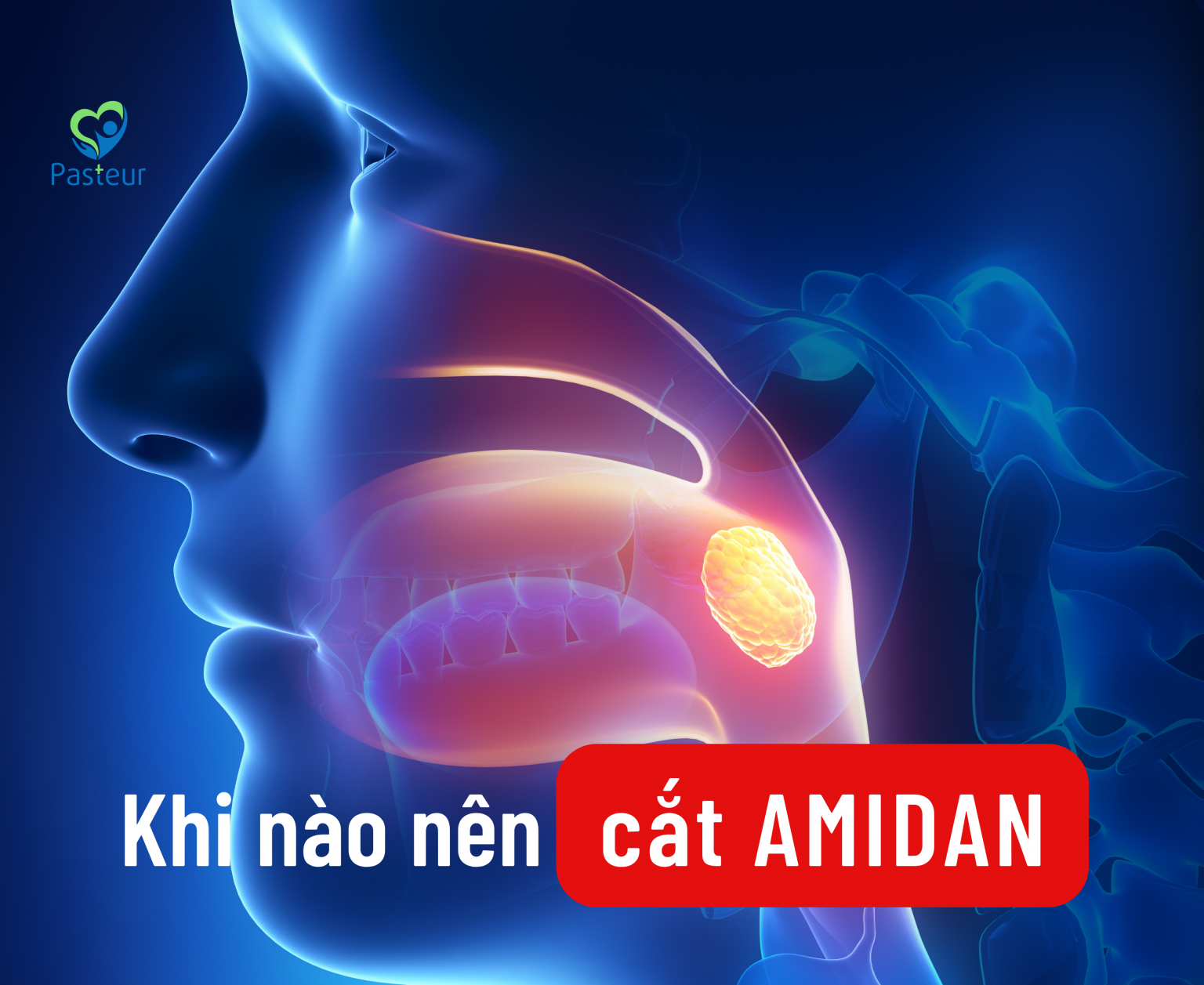 KHI NÀO NÊN CẮT AMIDAN?